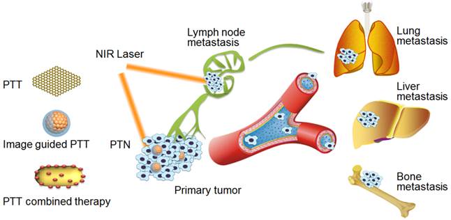 Current Approaches of Photothermal Therapy in Treating Cancer ...