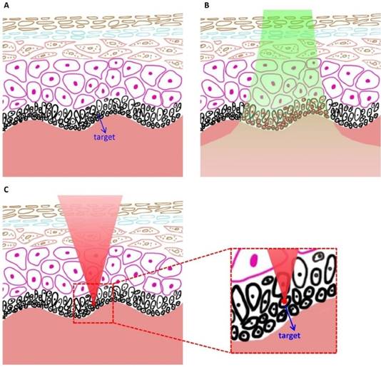 Precise Spatially Selective Photothermolysis Using Modulated ...
