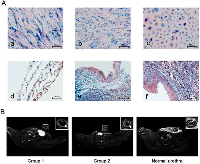 Fabrication of Tissue-Engineered Bionic Urethra Using Cell Sheet ...