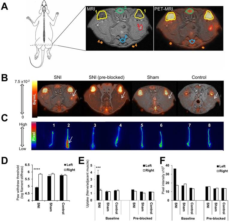 Visualizing Nerve Injury in a Neuropathic Pain Model with [18F]FTC-146 ...