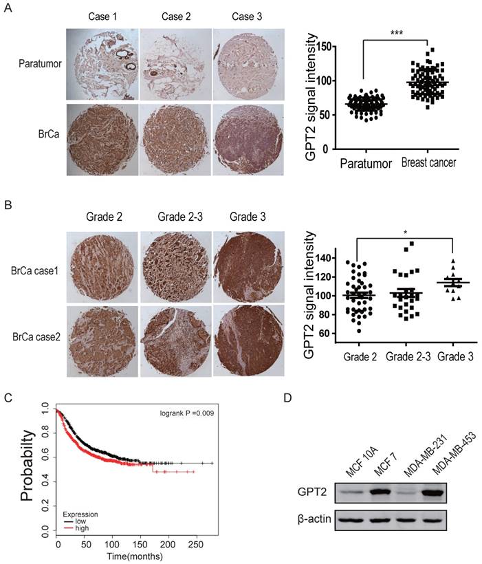 Glutamic Pyruvate Transaminase GPT2 Promotes Tumorigenesis of Breast ...