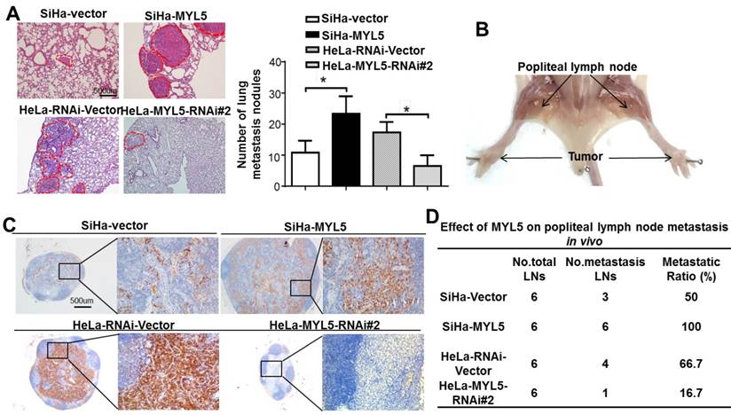 The Bidirectional Regulation between MYL5 and HIF-1α Promotes Cervical ...