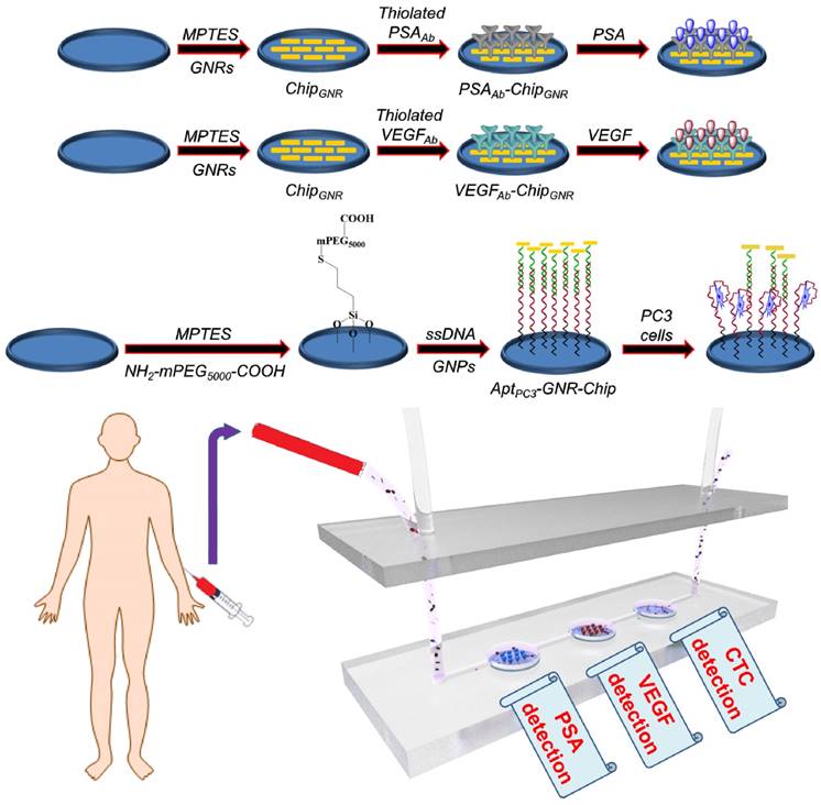 Label-Free Biochips for Accurate Detection of Prostate Cancer in the ...