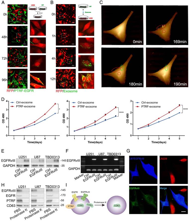 The role of PTRF/Cavin1 as a biomarker in both glioma and serum exosomes