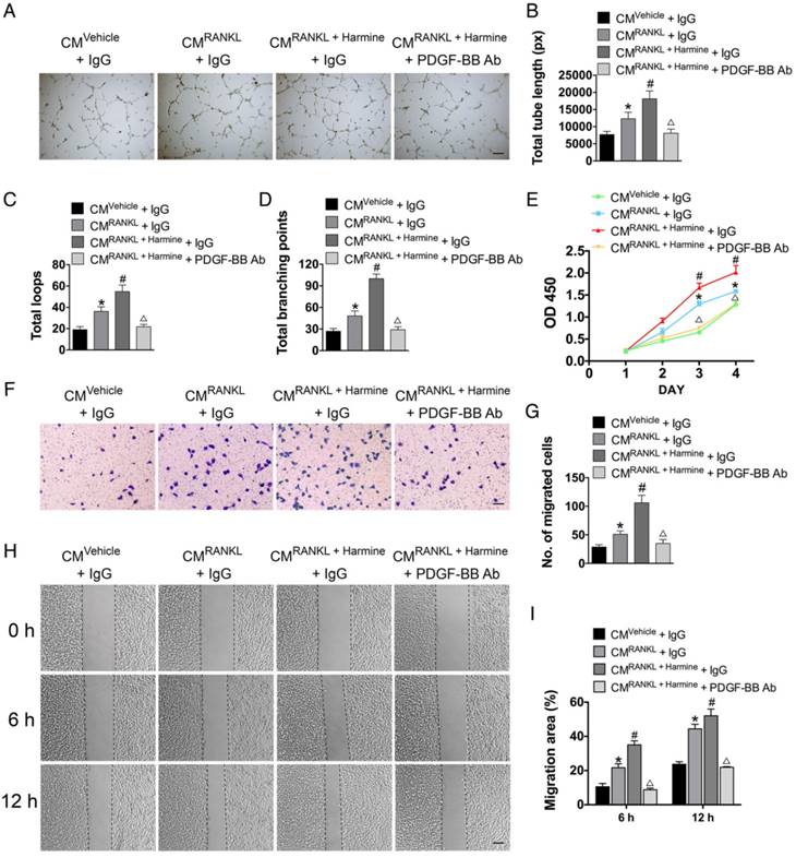 Harmine enhances type H vessel formation and prevents bone loss in ...