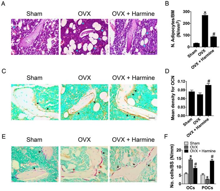 Harmine enhances type H vessel formation and prevents bone loss in ...