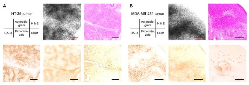 Cancer radiotheranostics targeting carbonic anhydrase-IX with 111In ...