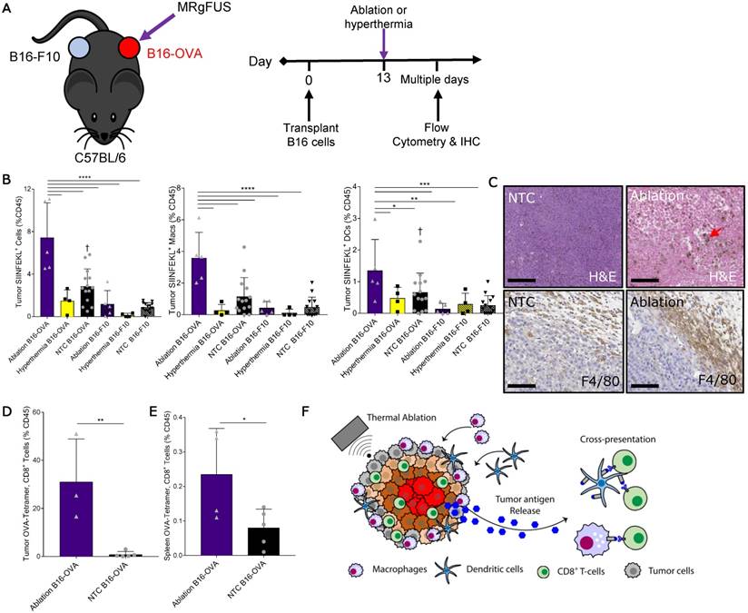 Distinct immune signatures in directly treated and distant tumors ...