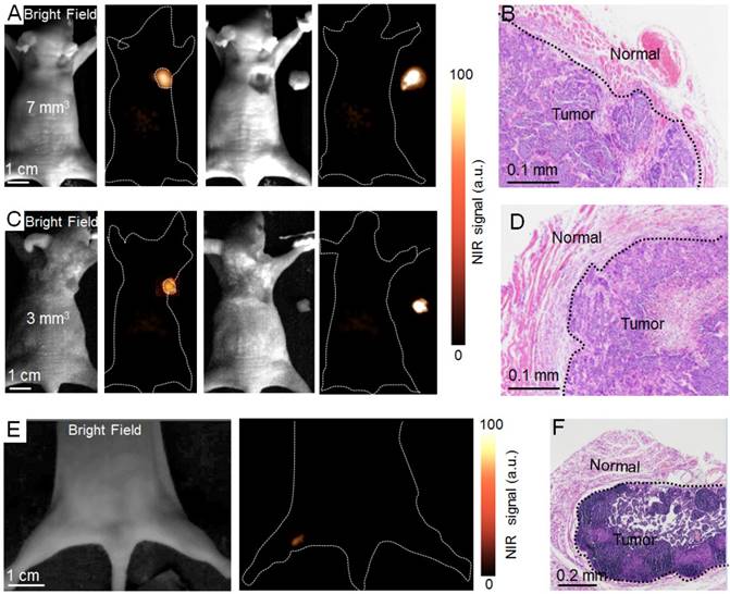 Fabrication of Red Blood Cell-Based Multimodal Theranostic Probes for ...