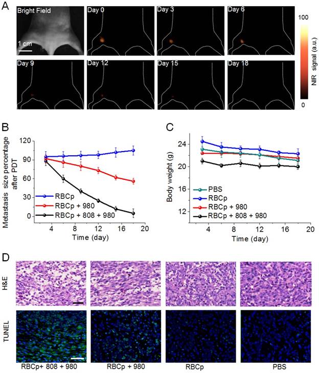 Fabrication of Red Blood Cell-Based Multimodal Theranostic Probes for ...