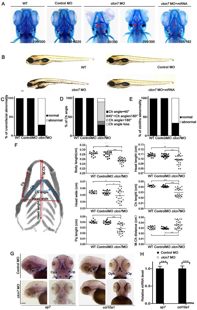 ClC-7 Regulates the Pattern and Early Development of Craniofacial Bone ...