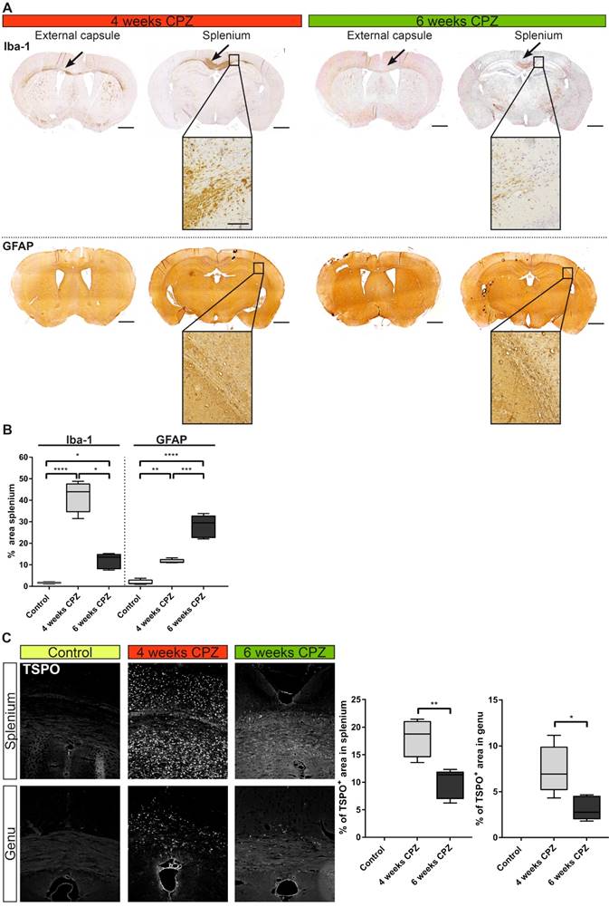 Molecular Imaging of Immune Cell Dynamics During De- and Remyelination ...