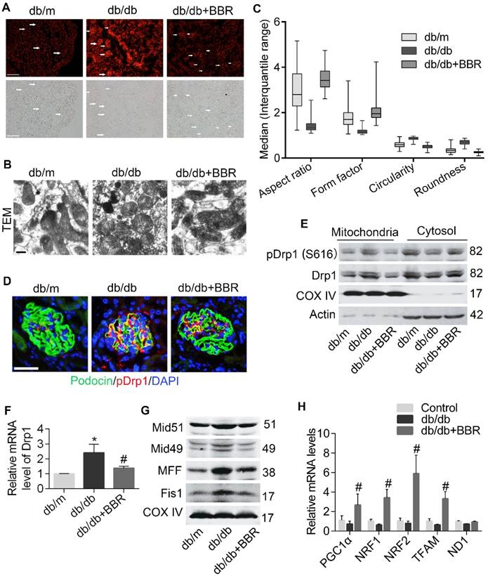 Berberine Protects Glomerular Podocytes via Inhibiting Drp1-Mediated ...