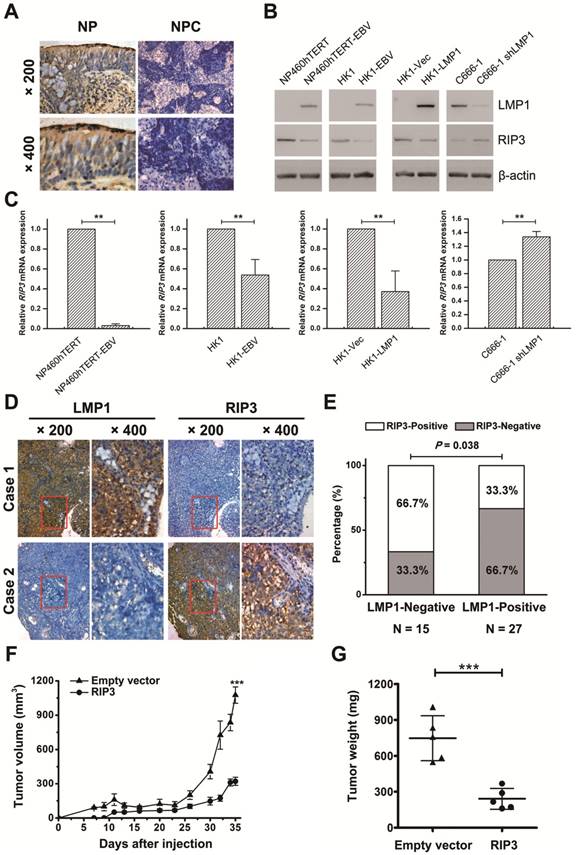 EBV(LMP1)-induced metabolic reprogramming inhibits necroptosis through ...