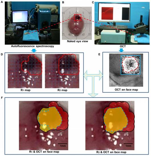 Dual-modality optical diagnosis for precise in vivo identification of ...