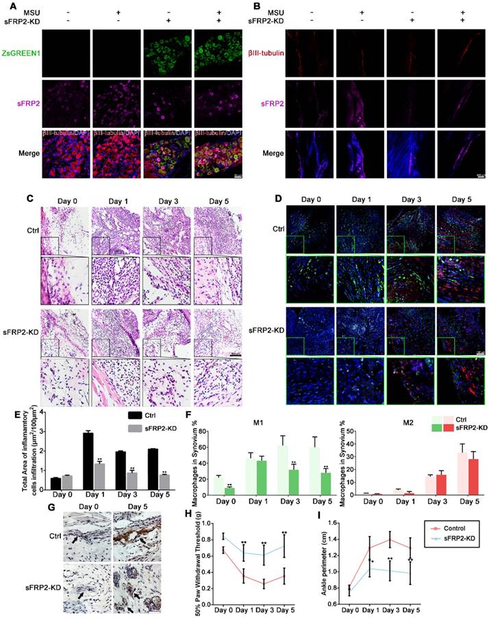 Nerve modulation therapy in gouty arthritis: targeting increased sFRP2 ...