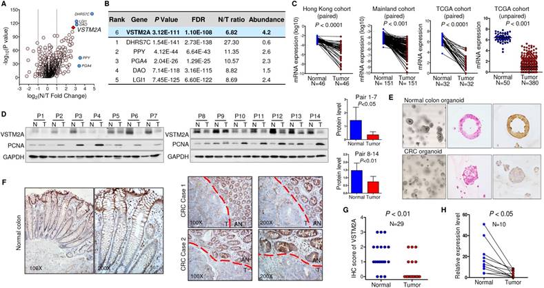 VSTM2A suppresses colorectal cancer and antagonizes Wnt signaling ...