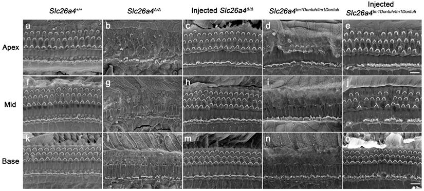 Gene therapy for hereditary hearing loss by SLC26A4 mutations in mice ...