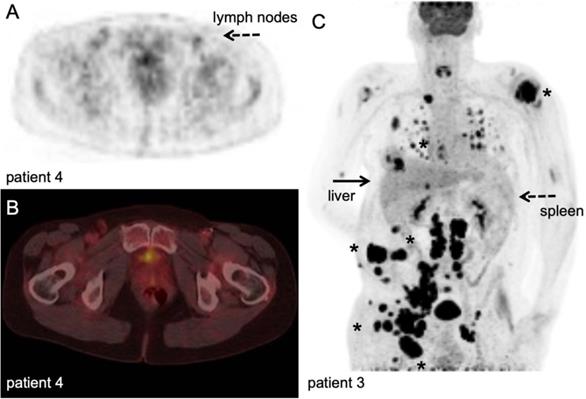 Imaging of T-cells and their responses during anti-cancer immunotherapy