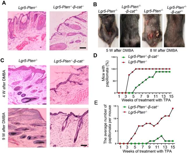 Pten loss in Lgr5+ hair follicle stem cells promotes SCC development