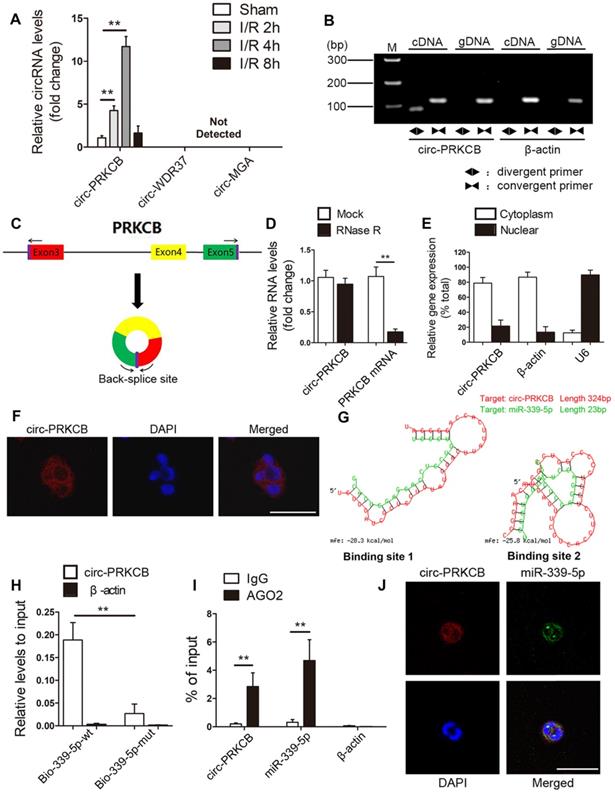 circ-PRKCB acts as a ceRNA to regulate p66Shc-mediated oxidative stress ...