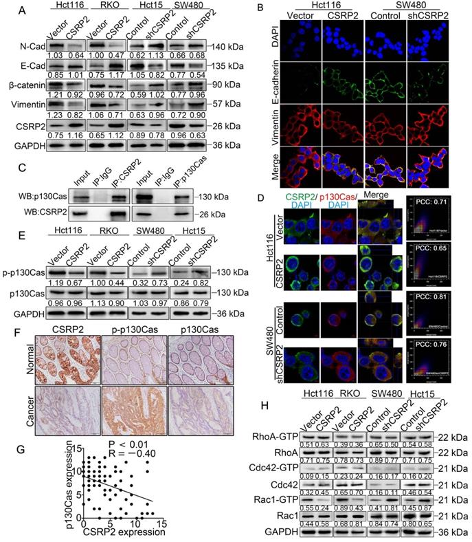 CSRP2 suppresses colorectal cancer progression via p130Cas/Rac1 axis ...