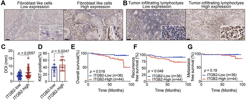 ITGB2-mediated metabolic switch in CAFs promotes OSCC proliferation by ...