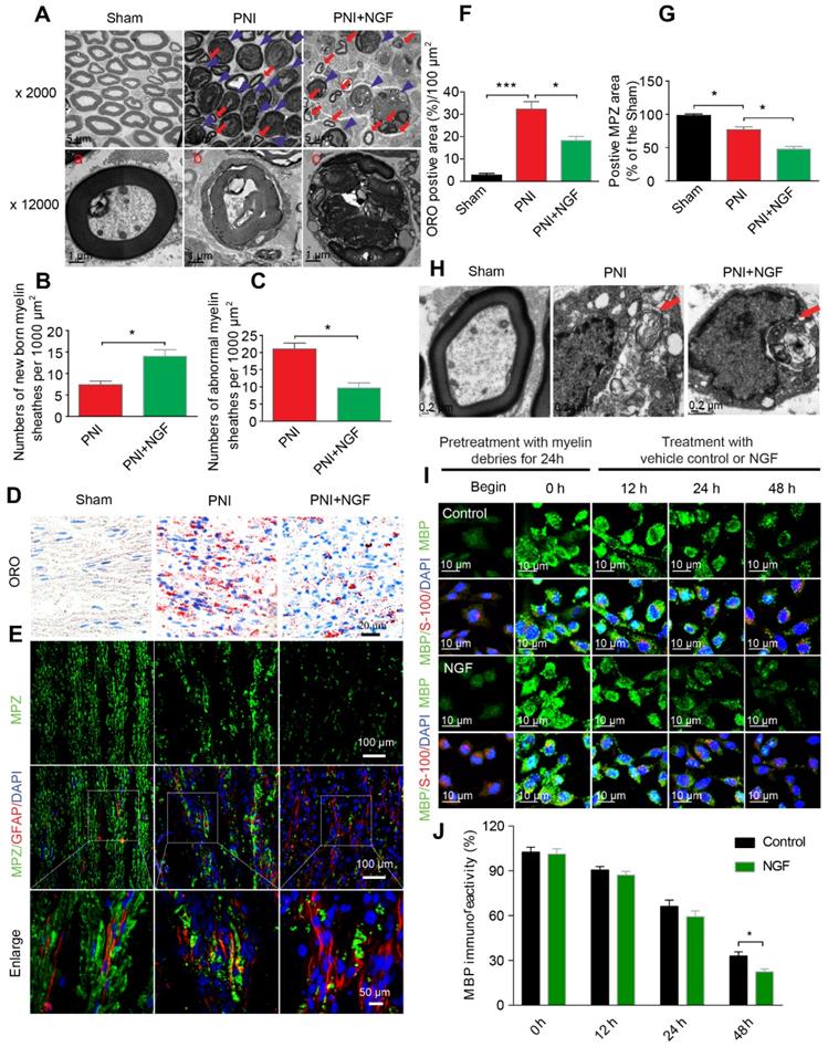 Nerve growth factor activates autophagy in Schwann cells to enhance ...