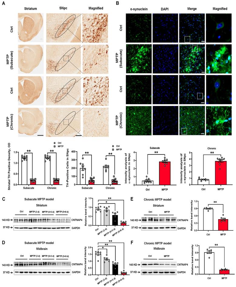 CNTNAP4 deficiency in dopaminergic neurons initiates parkinsonian ...