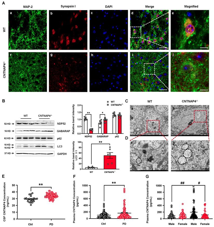 CNTNAP4 deficiency in dopaminergic neurons initiates parkinsonian ...