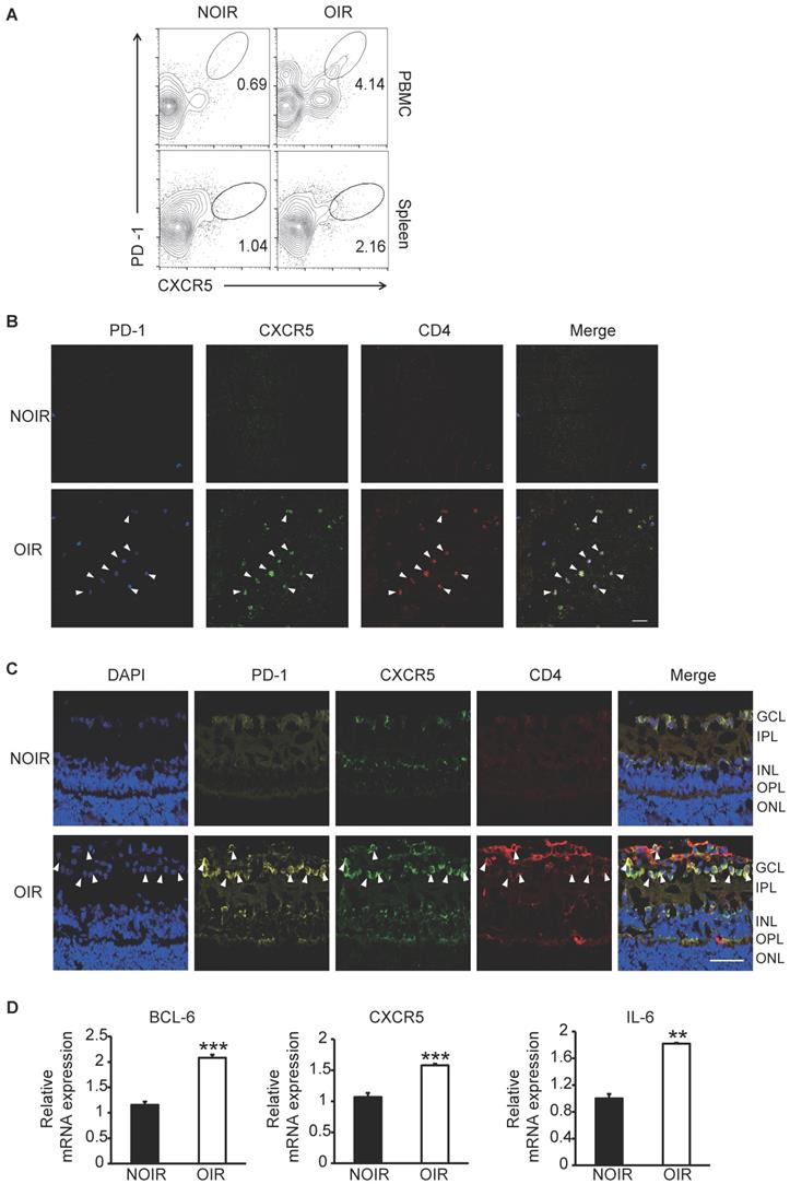 Bcl-6-directed follicular helper T cells promote vascular inflammatory ...