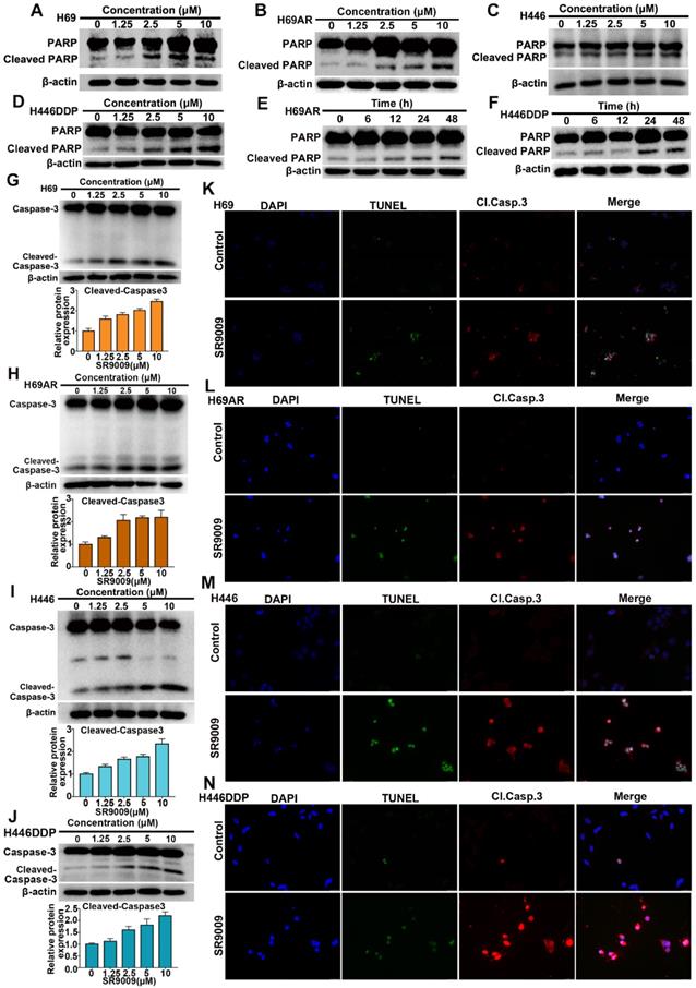 SR9009 induces a REV-ERB dependent anti-small-cell lung cancer effect ...