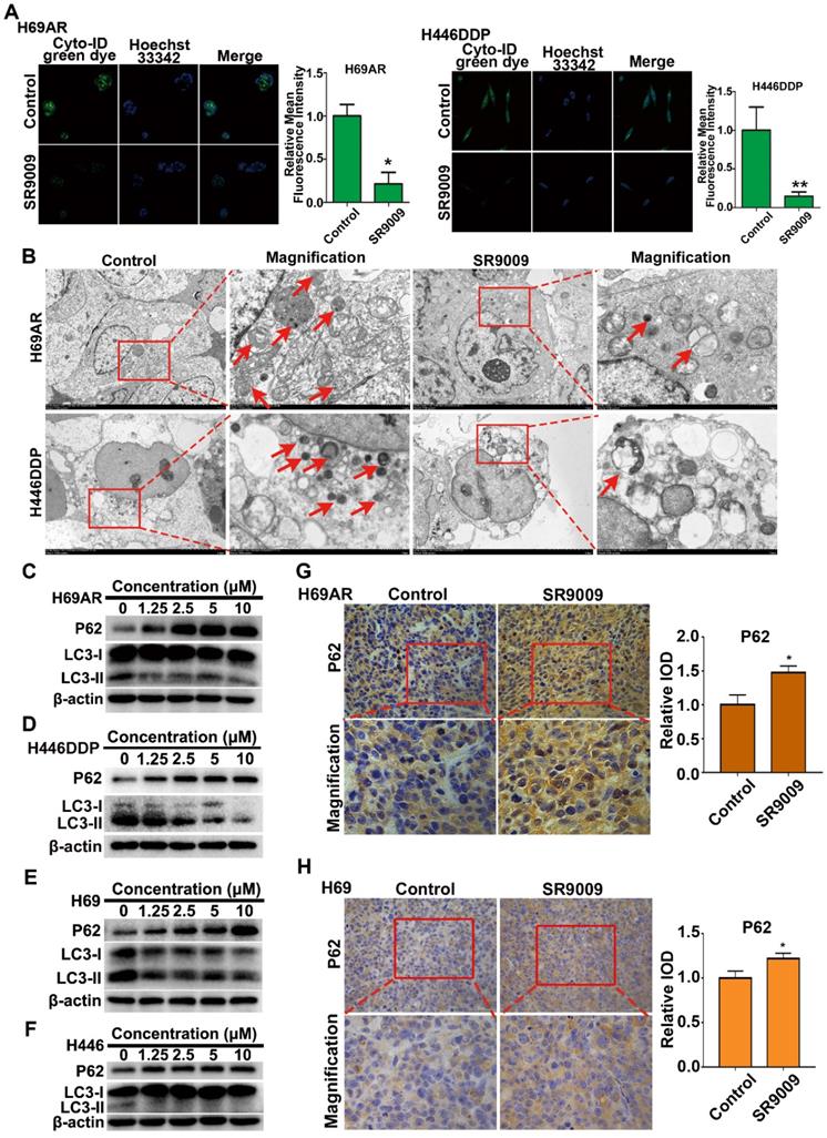 SR9009 induces a REV-ERB dependent anti-small-cell lung cancer effect ...