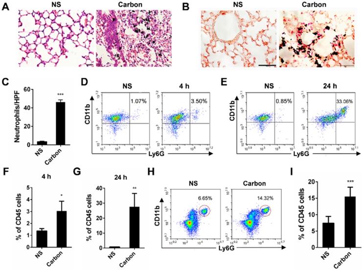 Carbon black nanoparticles induce cell necrosis through lysosomal ...