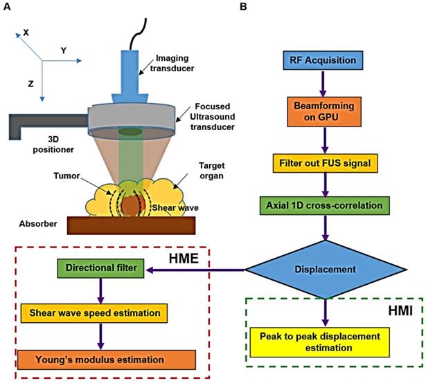 Noninvasive Young's modulus visualization of fibrosis progression and ...