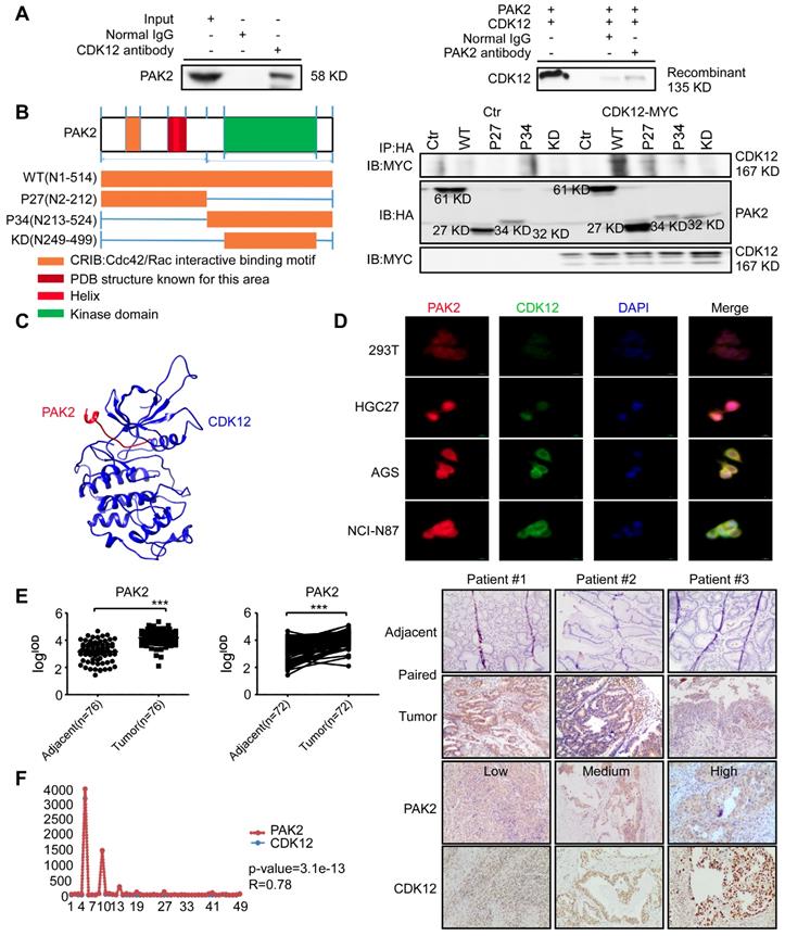 CDK12 and PAK2 as novel therapeutic targets for human gastric cancer