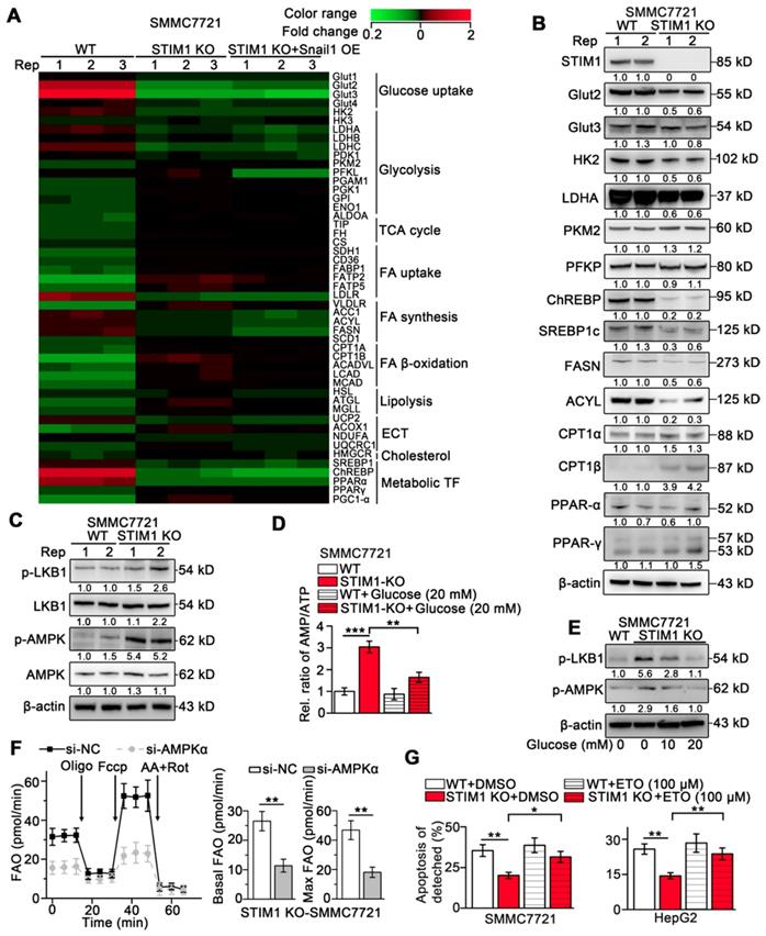 STIM1 is a metabolic checkpoint regulating the invasion and metastasis ...