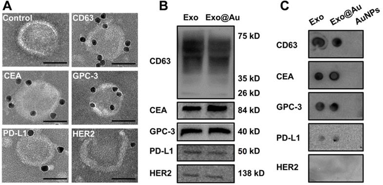 Nanozyme-assisted sensitive profiling of exosomal proteins for rapid ...