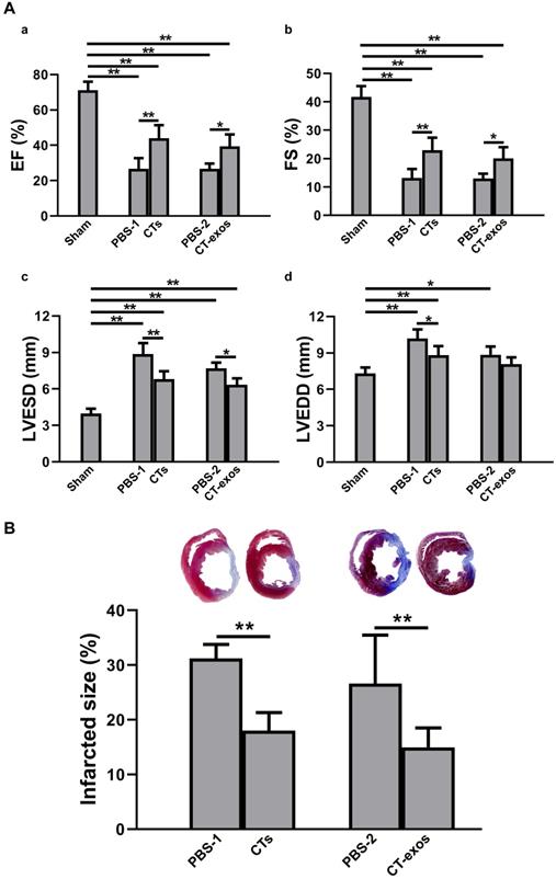 Cardiac telocytes inhibit cardiac microvascular endothelial cell ...
