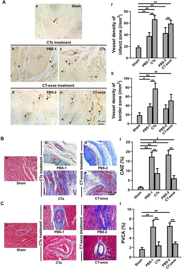 Cardiac telocytes inhibit cardiac microvascular endothelial cell ...