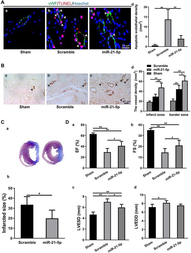 Cardiac telocytes inhibit cardiac microvascular endothelial cell ...