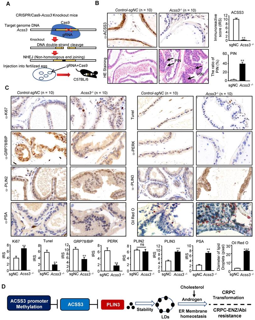 ACSS3 represses prostate cancer progression through downregulating ...