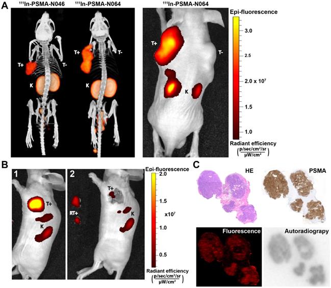 Photosensitizer-based multimodal PSMA-targeting ligands for ...