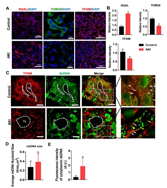 Mitochondrial ROS promote mitochondrial dysfunction and inflammation in ...