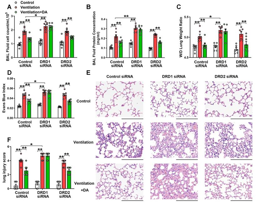 DRD1 downregulation contributes to mechanical stretch-induced lung ...