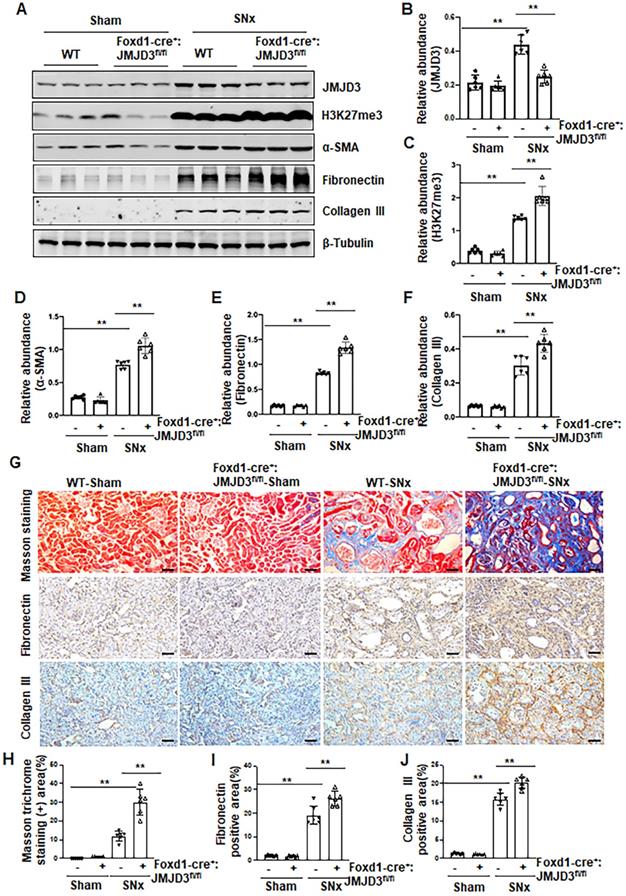 Histone demethylase JMJD3 protects against renal fibrosis by ...