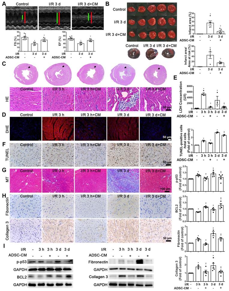 Conditioned medium from adipose-derived stem cells attenuates ischemia ...
