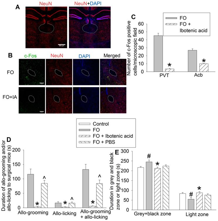 Paraventricular thalamic nucleus plays a critical role in consolation ...