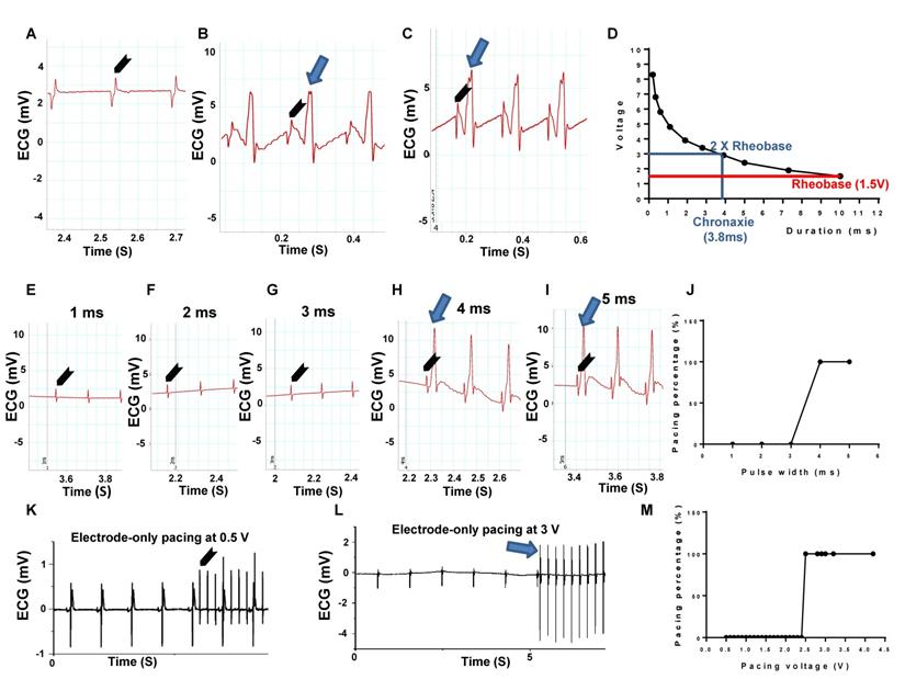 Injectable conductive hydrogel can reduce pacing threshold and enhance ...