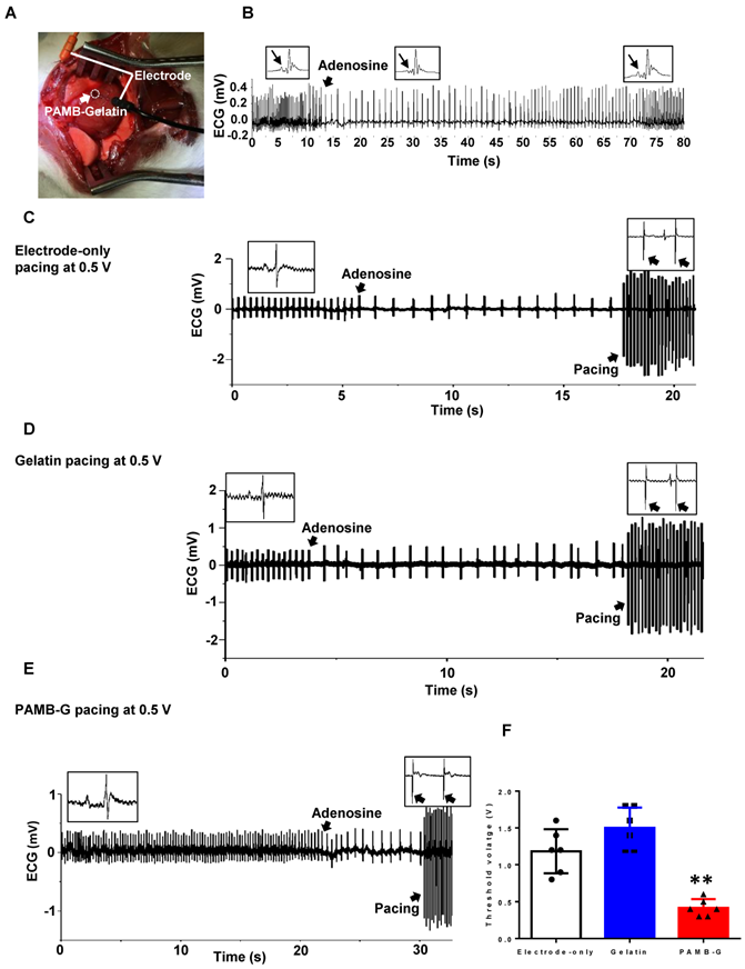 Injectable conductive hydrogel can reduce pacing threshold and enhance ...